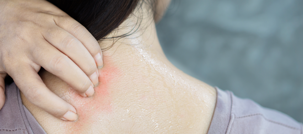 ¿Por qué sudamos y qué es el sudor?| Driosec